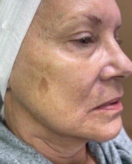 Gallery - Affiliated Troy Dermatologists